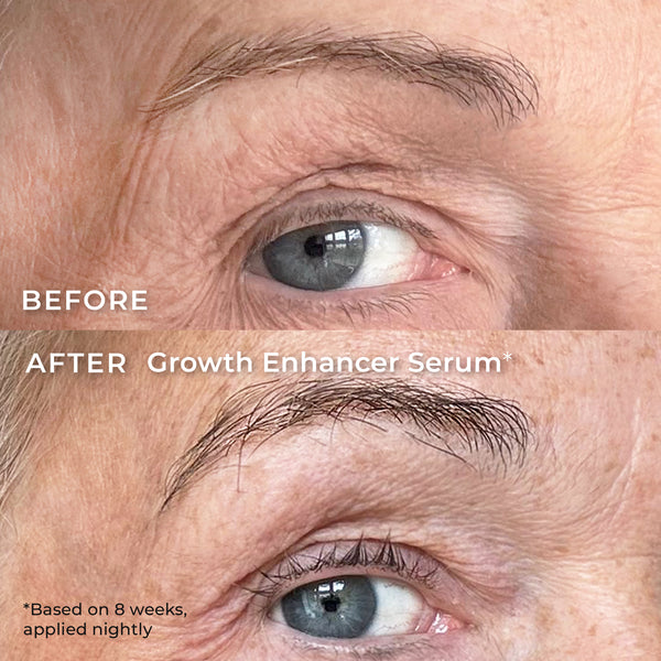 Growth Enhancer Brow & Lash Serum - Dermatologist Approved | Wunderbrow